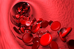 Blood Flow Restriction Training for Physical Therapists – HomeCEU